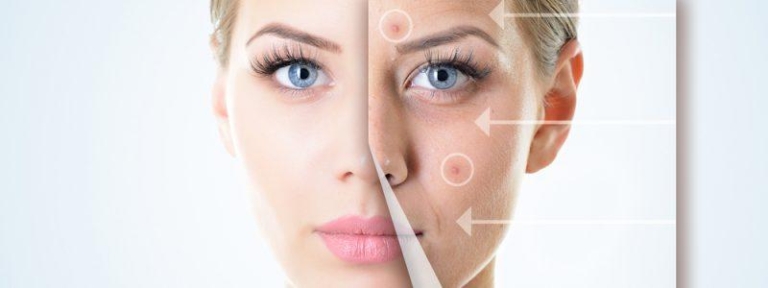 Basis acnebehandeling – Aura Skin Academy